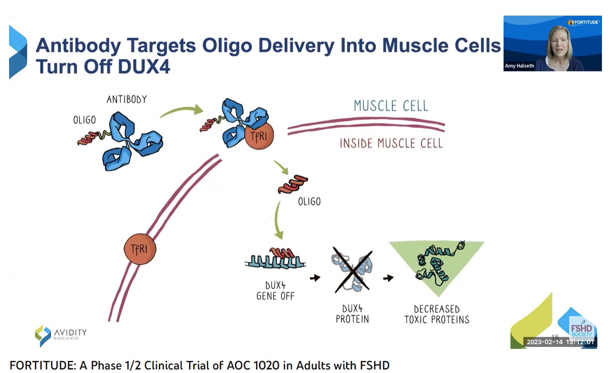 FSHD | Essai Fortitude - Groupe d'intérêt FSHD de l'AFM-Téléthon